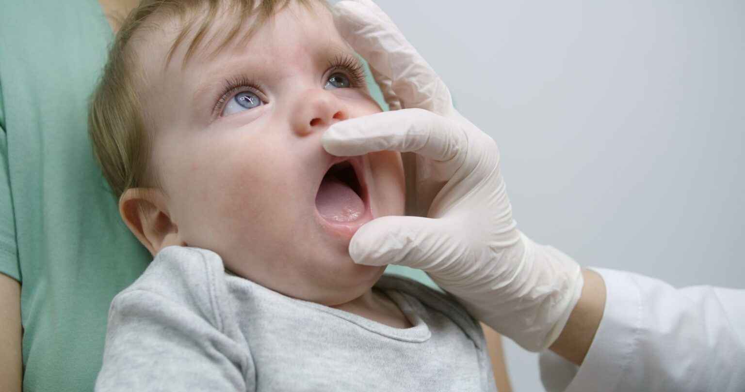 How Early Detection Helps Your Child’s Growing Smile | Coral Kids ...